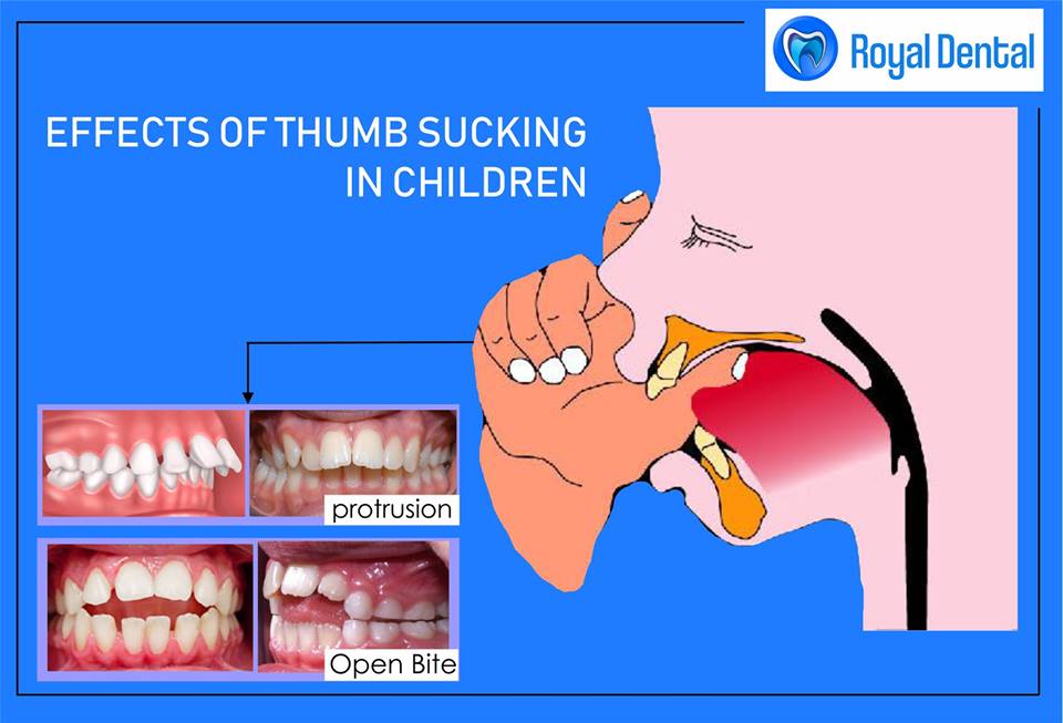 Royal Dental | BLOG
